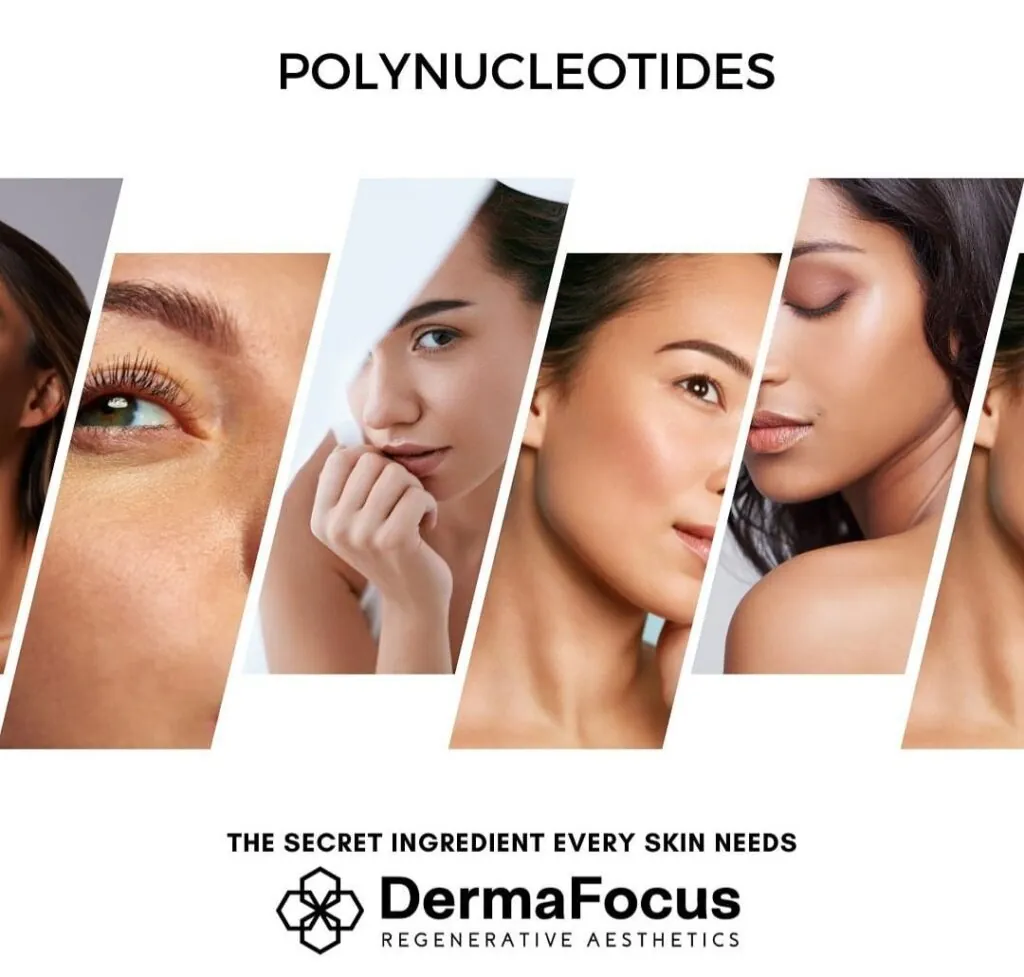 Polynucleotide Treatment London | Solihull | Polynucleotide clinics in ...